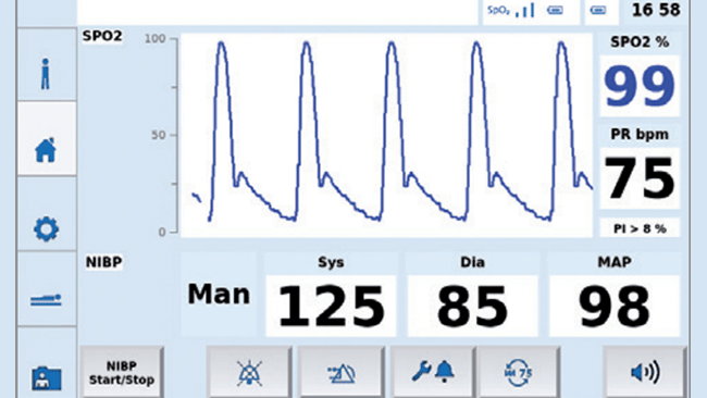 Tesla DUO - MRI Monitor | MIPM Mammendorfer Institut für Physik und ...